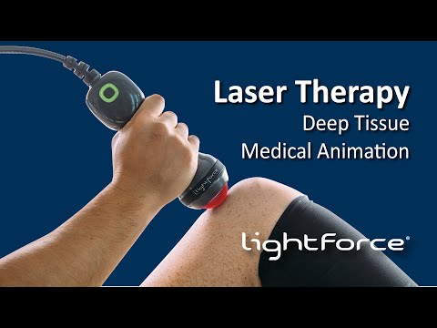 How to Talk About Laser Therapy (So People Understand It) | Chattanooga