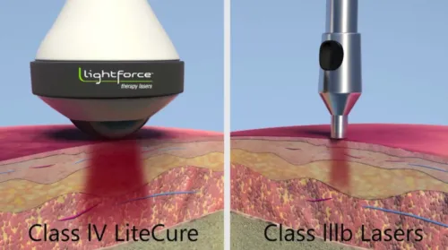 Laser Therapy FAQ 4 – If Lower Doses of Laser Light Can Help Tissue ...